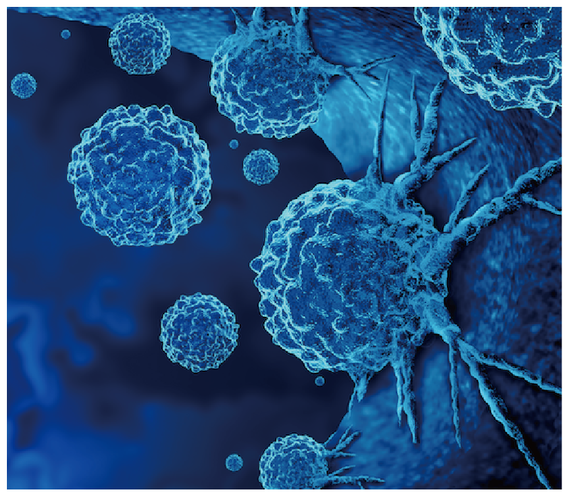 hWGS & hWES Case Study on Endocervical Adenocarcinomas